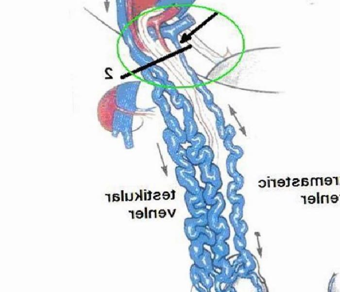 VARİKOSEL - Doktor Makaleleri